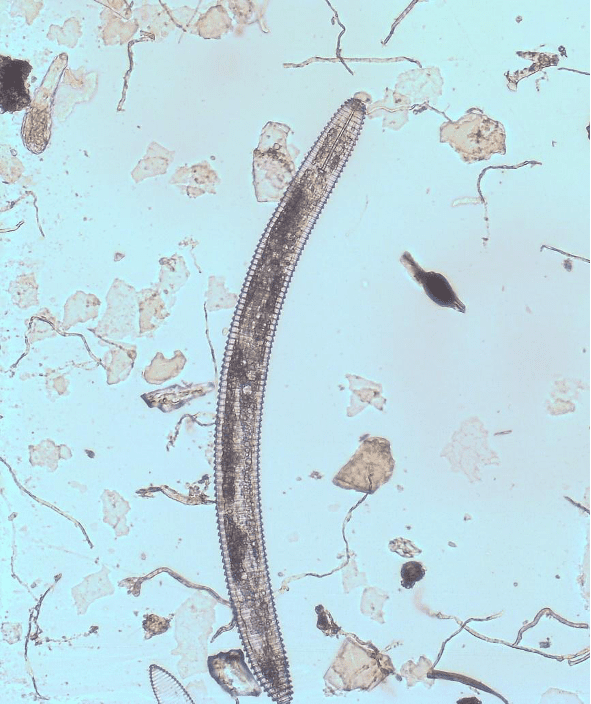 What Are Nematodes? Are They Good or Bad? | Teleos Ag Solutions