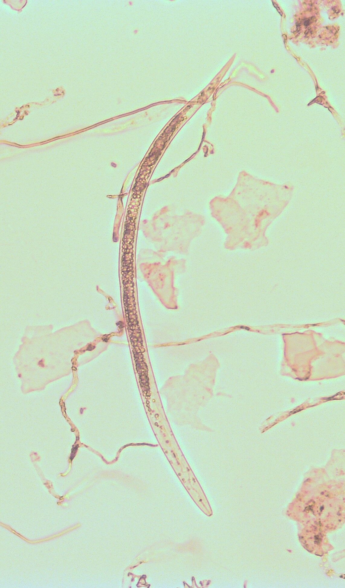 The 5 Most Common Plant-Parasitic Nematodes and How TELONE™ Can Help ...